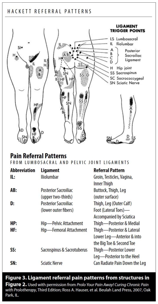 Pain-referral-Pattern - Prolotherapy PRP - Nashville